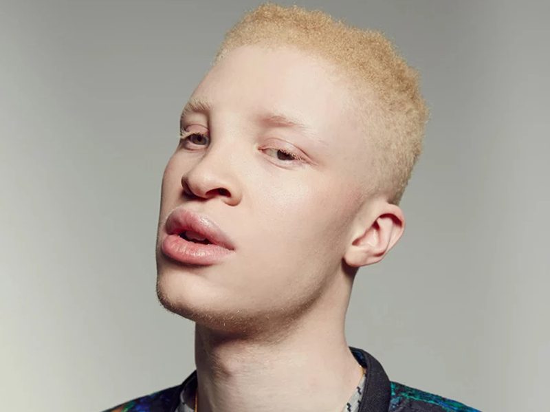 Снежная красота: невероятные альбиносы из разных стран | Фото новости ...